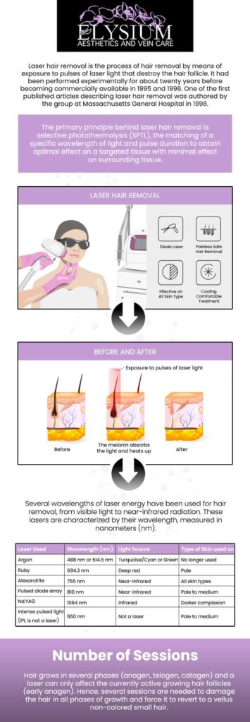 Long-Term Benefits of Professional Laser Hair Removal